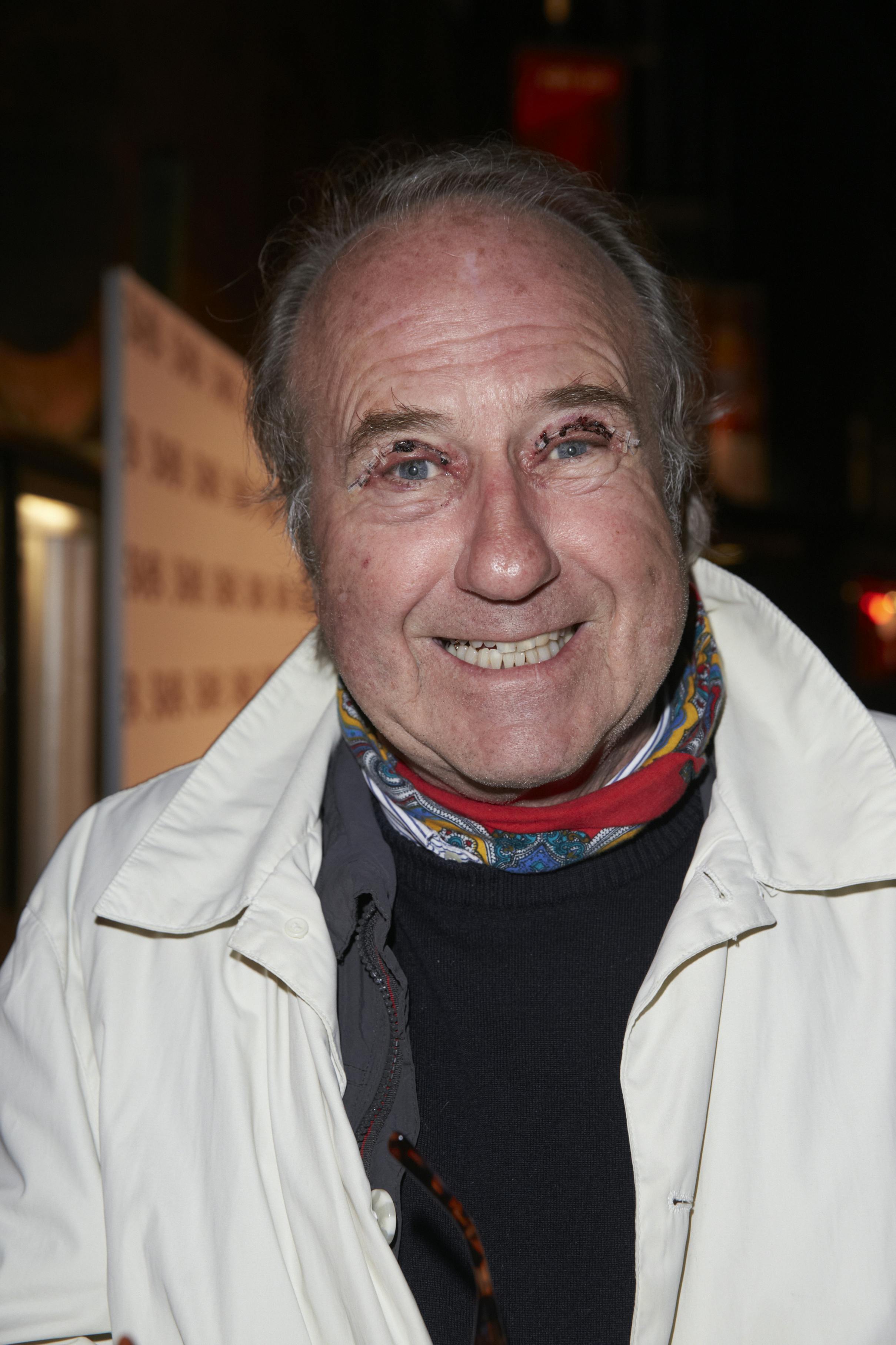 Erik Brandt i biffen trods øjenoperation | BILLED-BLADET